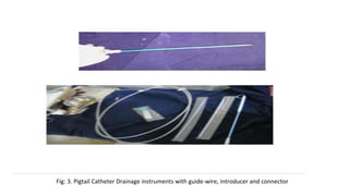 Liver Abscess ppt.pptx