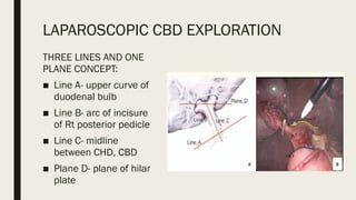 Anatomy of liver and biliary tree with its surgical importance.pptx