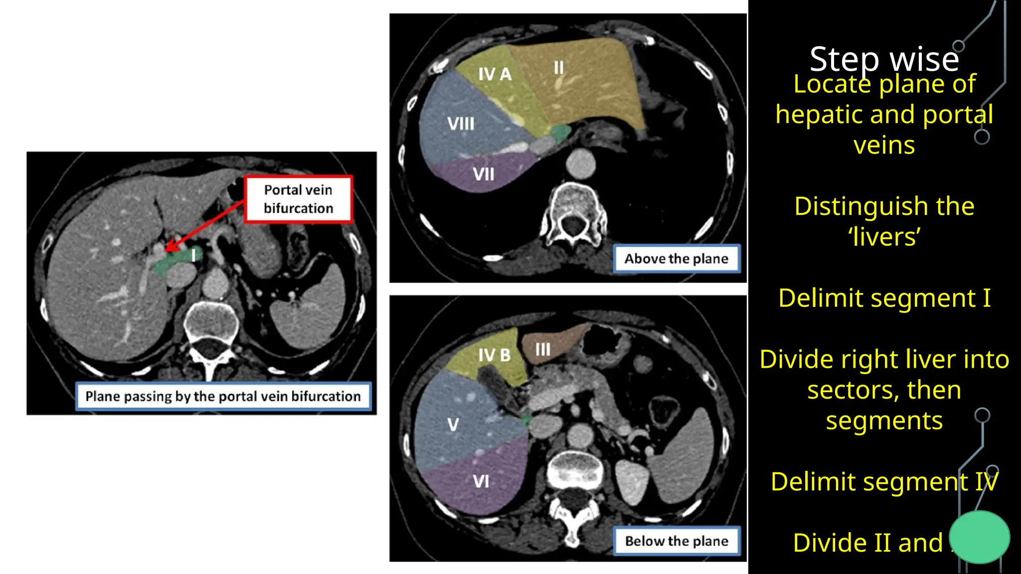 Liver and biliary tract - Normal anatomy and Imaging techniques.pptx