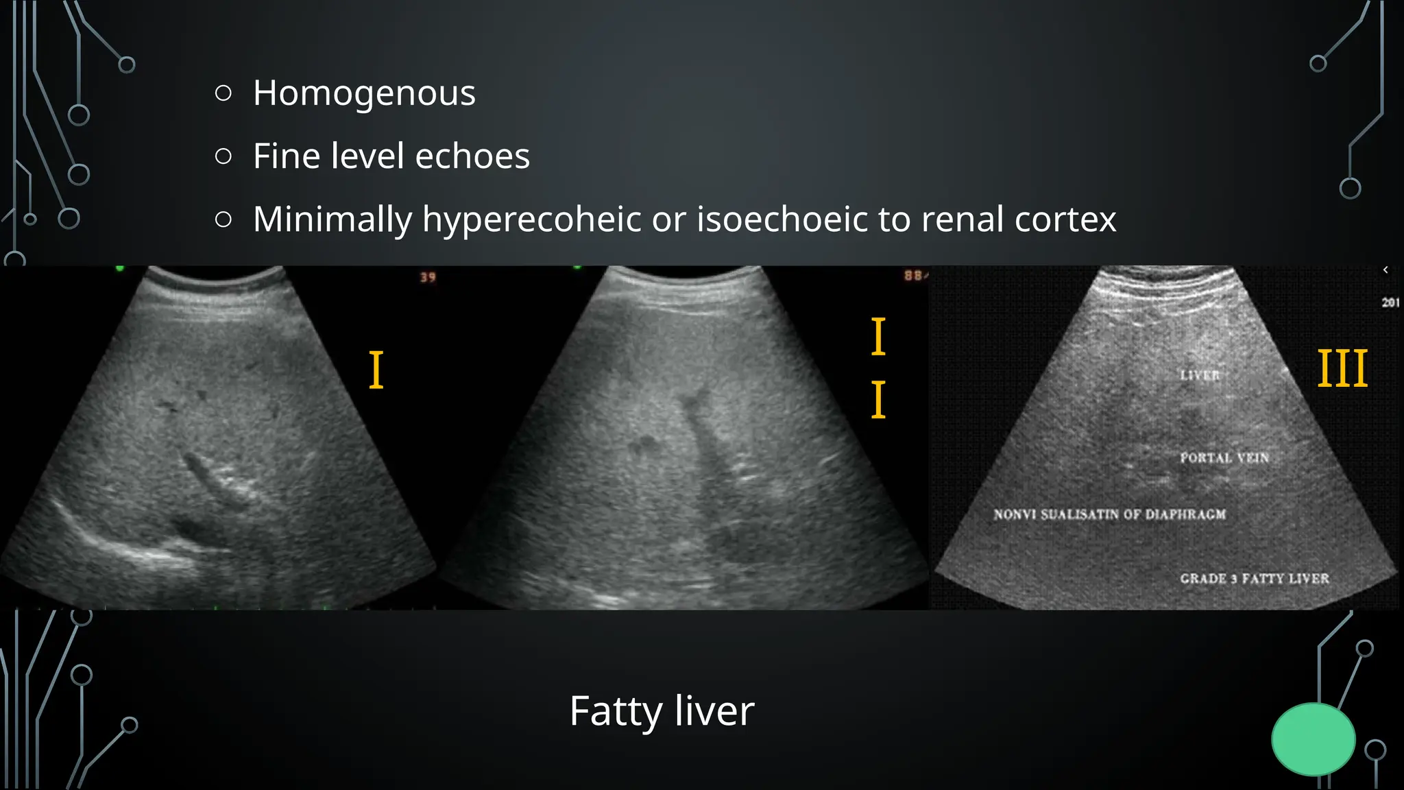 Liver and biliary tract - Normal anatomy and Imaging techniques.pptx