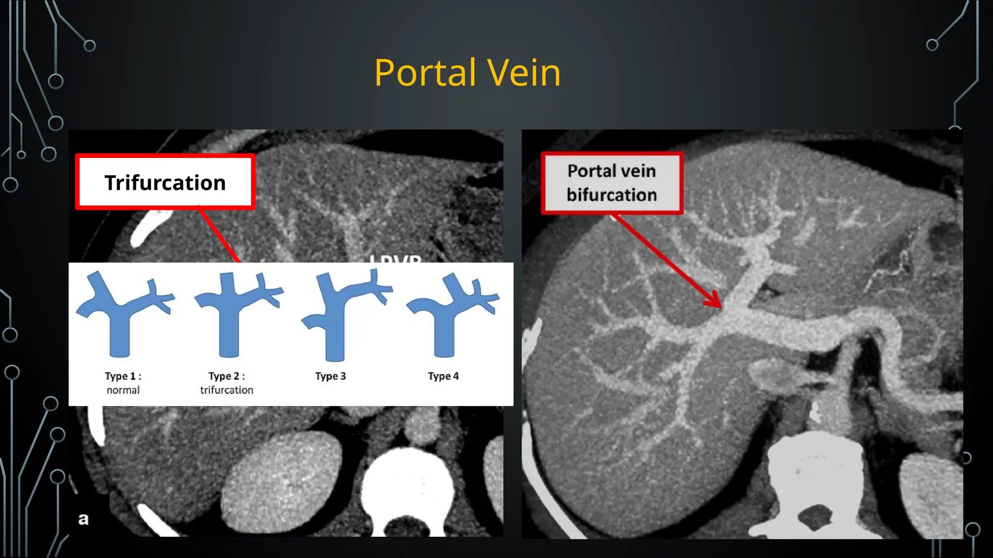 Liver and biliary tract - Normal anatomy and Imaging techniques.pptx