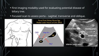 Liver and biliary tract - Normal anatomy and Imaging techniques.pptx