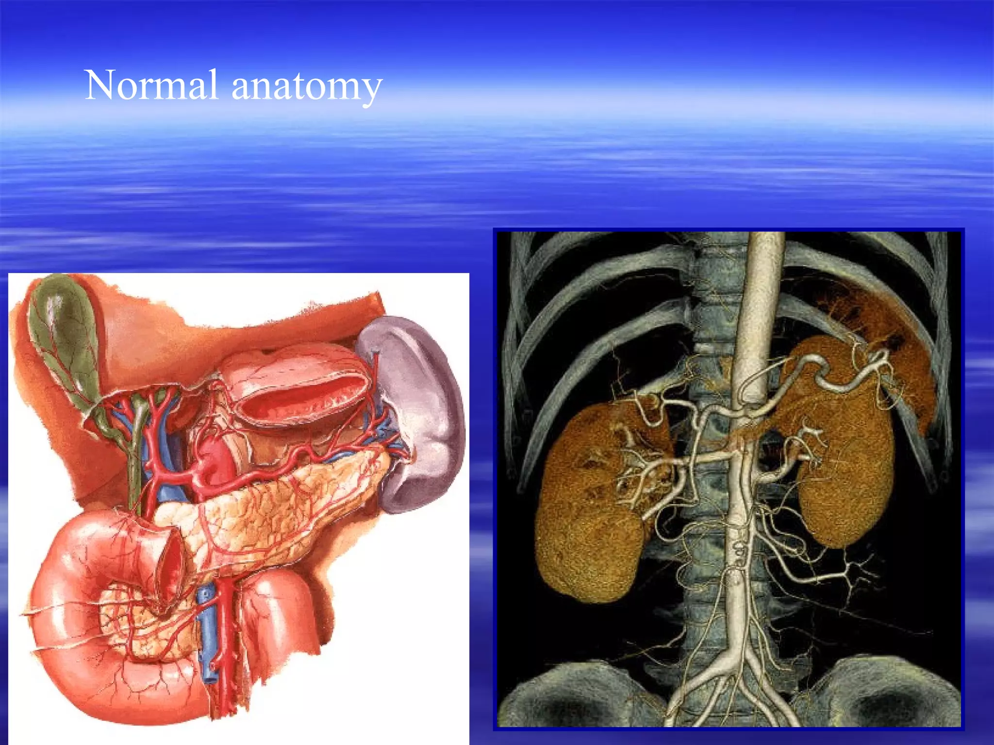Liver,bile duct,pancreas and spleen | PPT