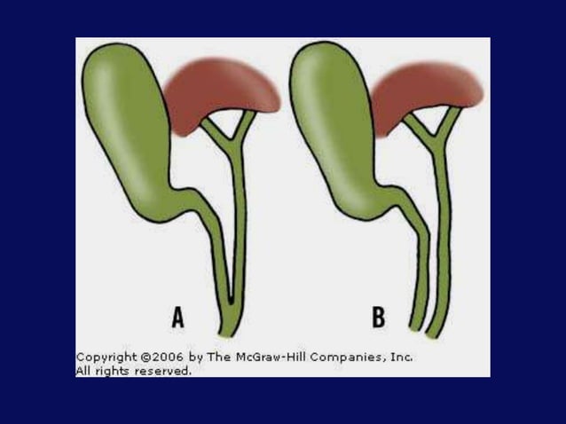 Liver& biliary | PPT