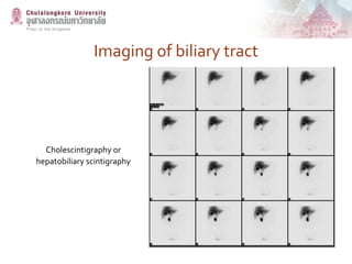 Anatomy of liver, biliary tract and portal system | PDF