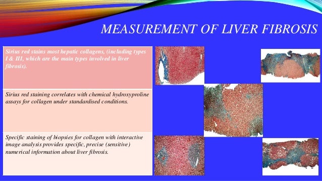 Liver biopsy