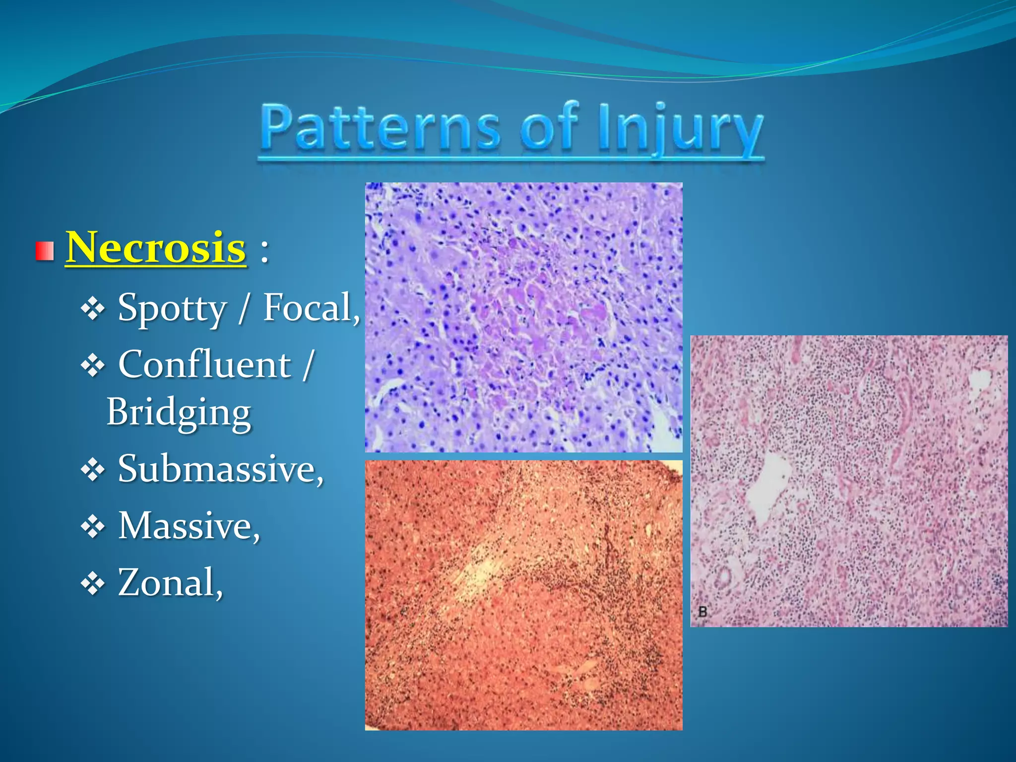 Liver biopsy interpretation | PPTX