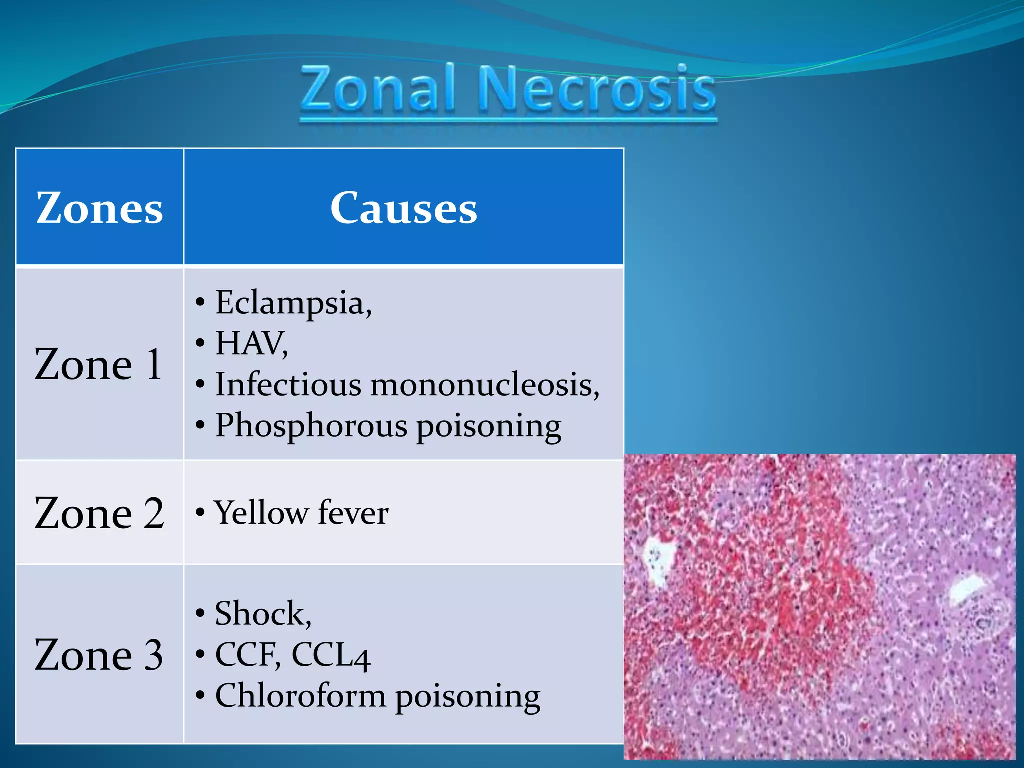 Liver biopsy interpretation | PPTX