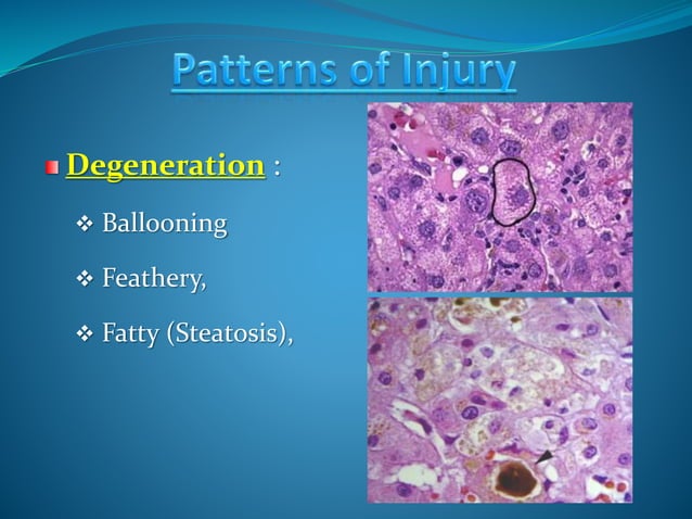 Liver biopsy interpretation | PPTX