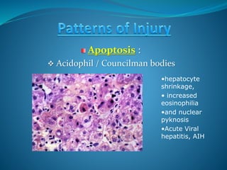 Liver biopsy interpretation | PPTX