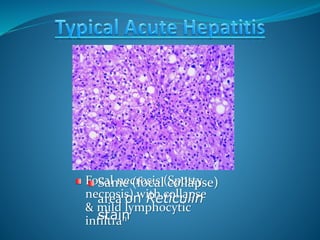 Liver biopsy interpretation | PPTX