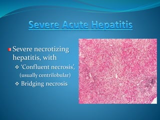 Liver biopsy interpretation | PPTX