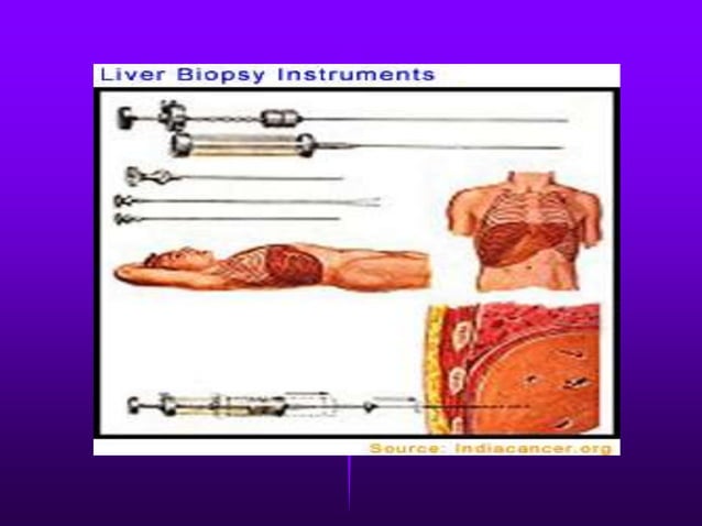 Liver biopsy interpretation | PPT | Free Download