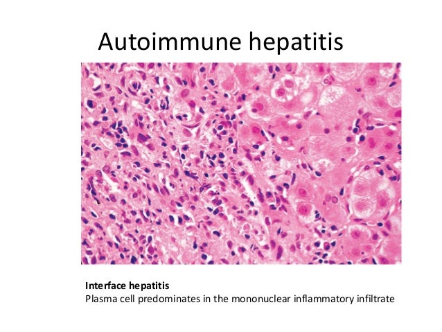 Liver biopsy interpretation