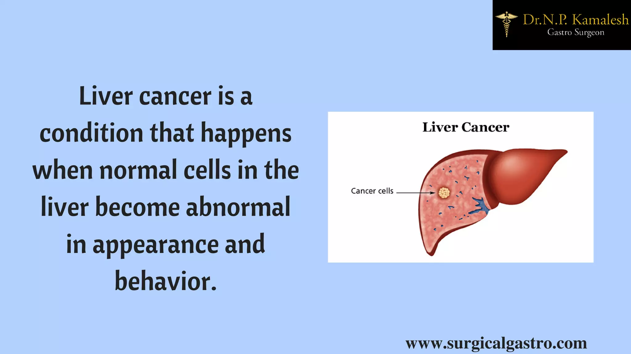 Liver Cancer Treatment In Kochi | Gastroenterologist In Kerala | PDF ...
