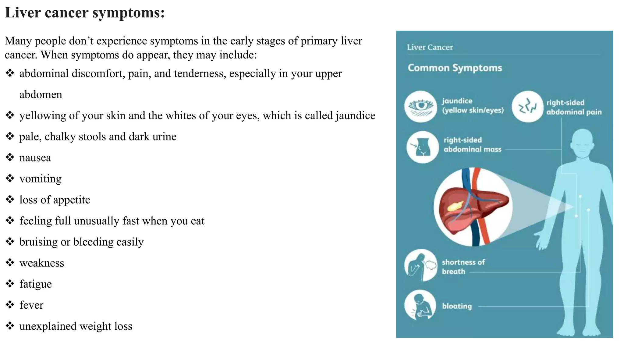 liver cancer.pptx