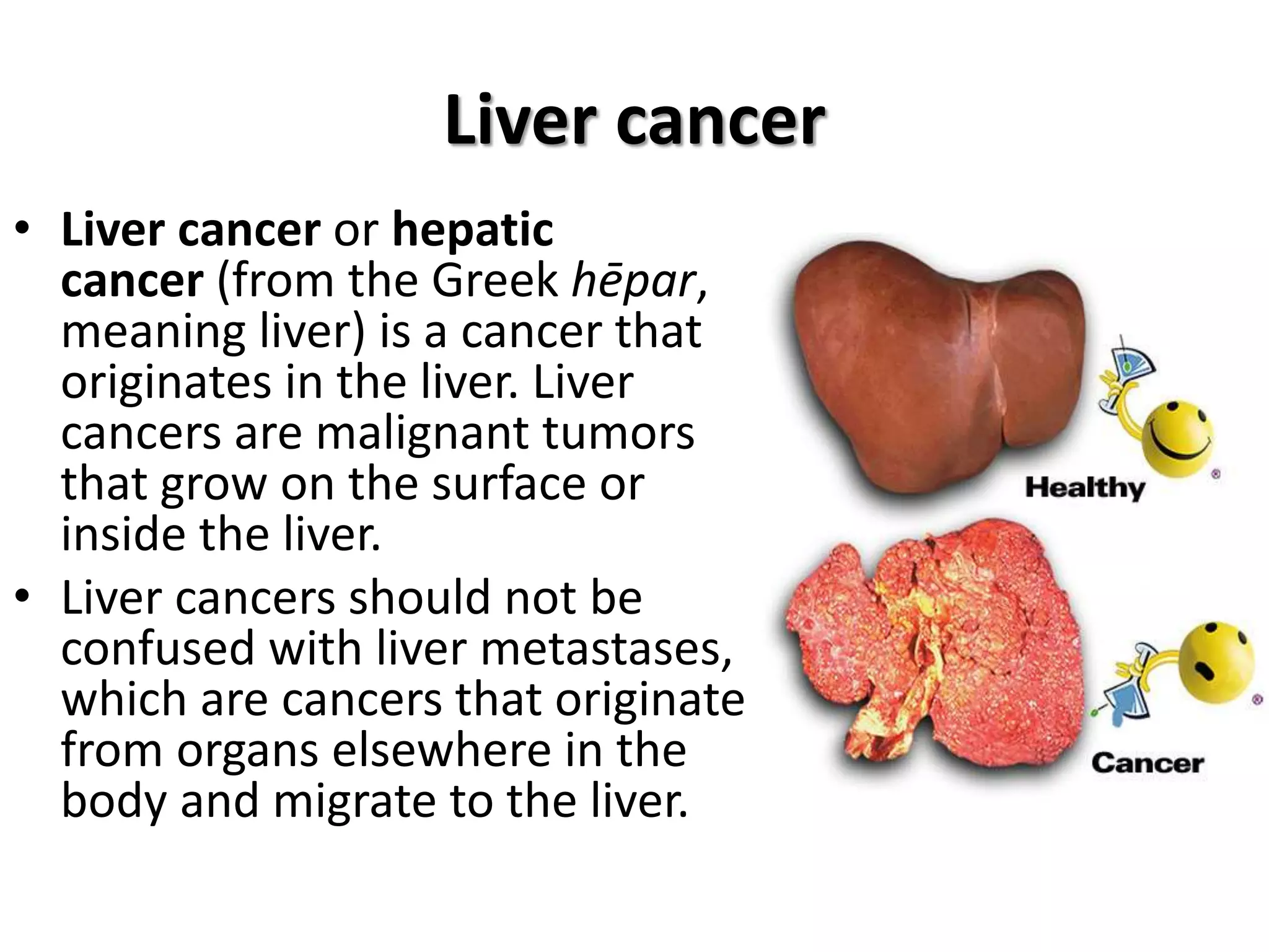 Liver cancer.pptx