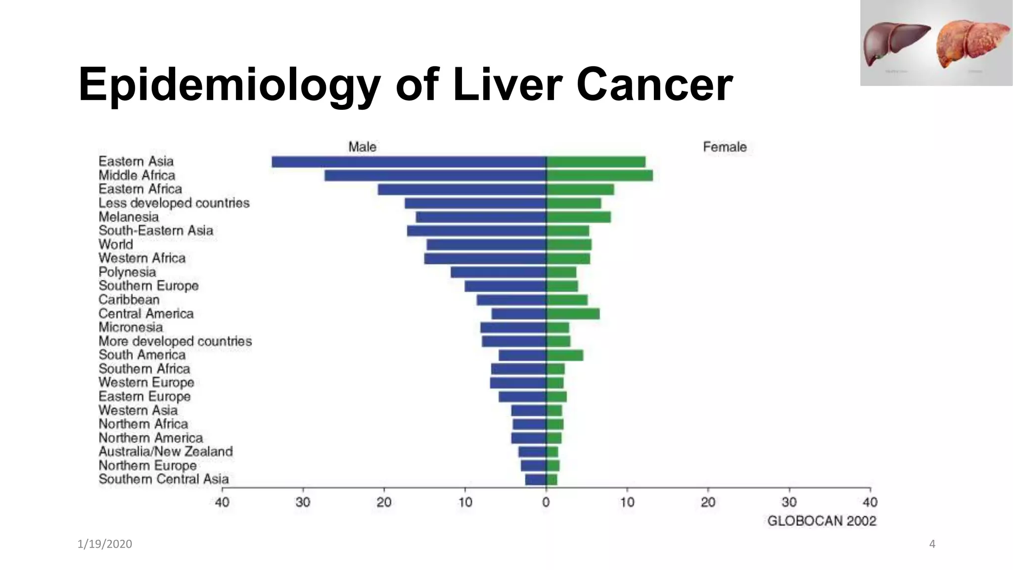 Liver Cancer: Epidemiology, Etiology, Prognosis and Treatment. | PPTX