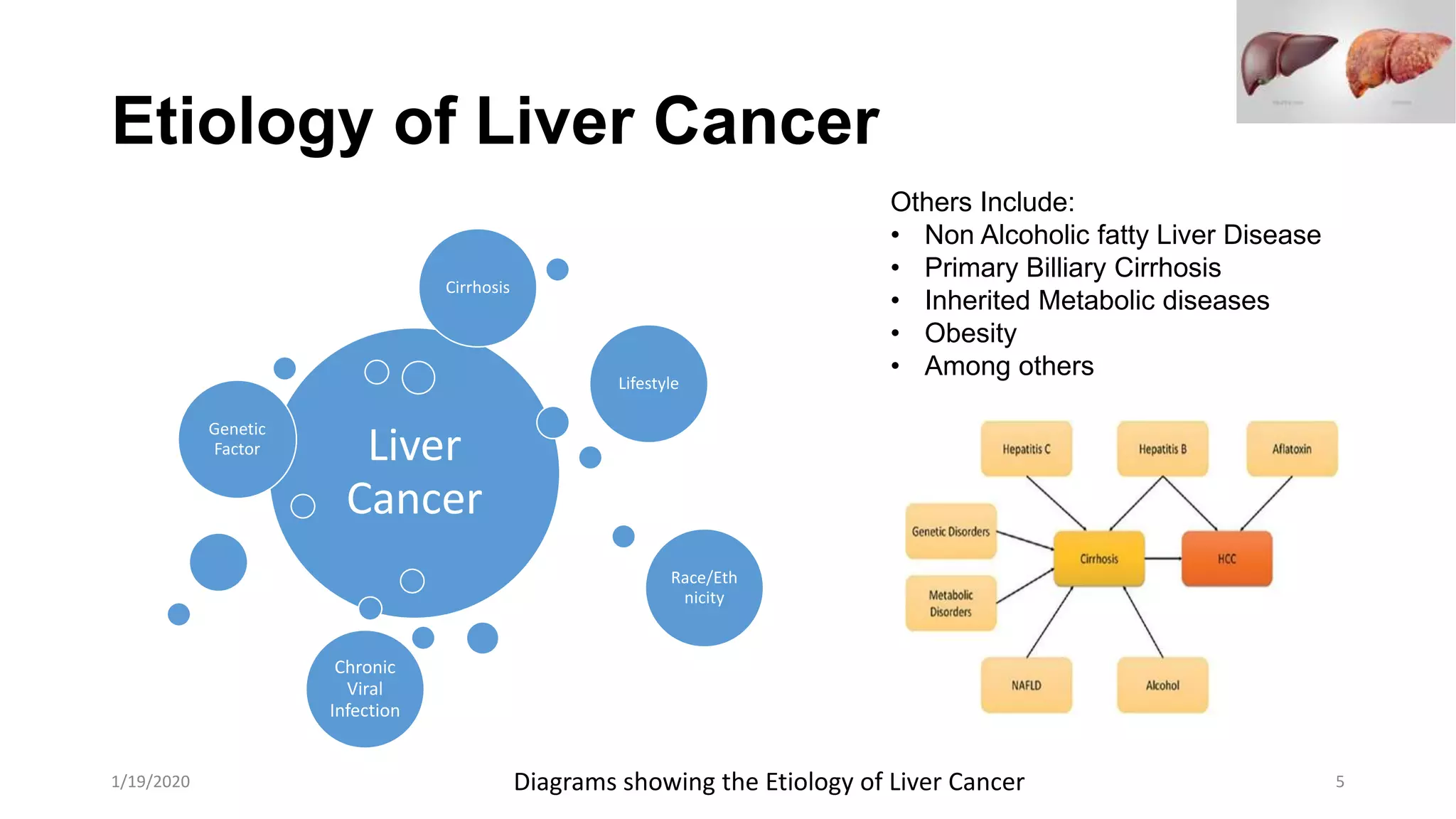 Liver Cancer: Epidemiology, Etiology, Prognosis and Treatment. | PPTX