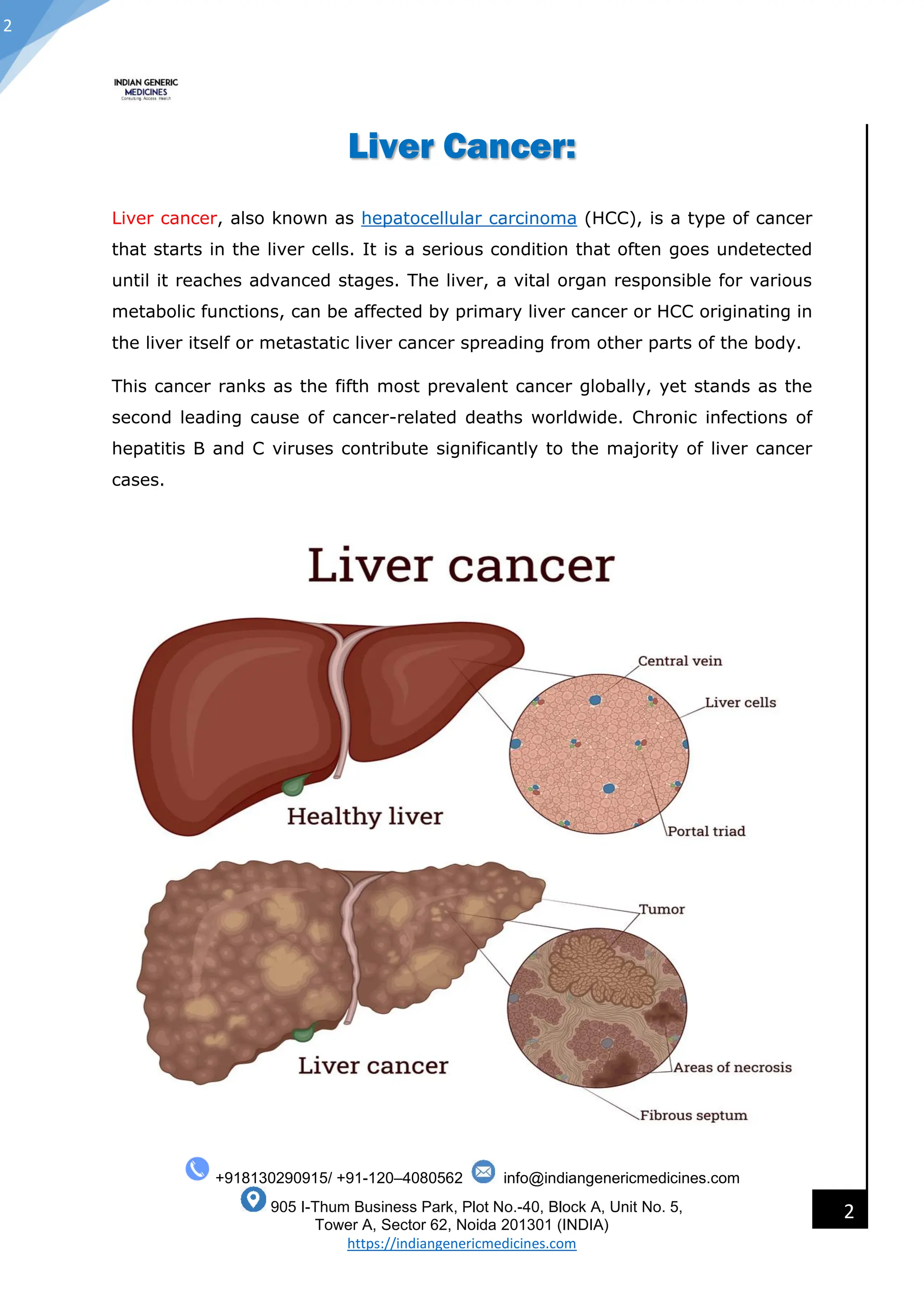Liver Cancer Symptoms, Treatments, and Prevention | PDF