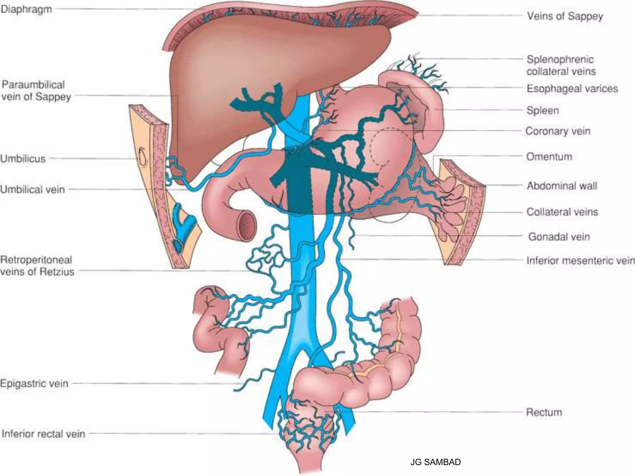 Liver cirrhosis | PPTX