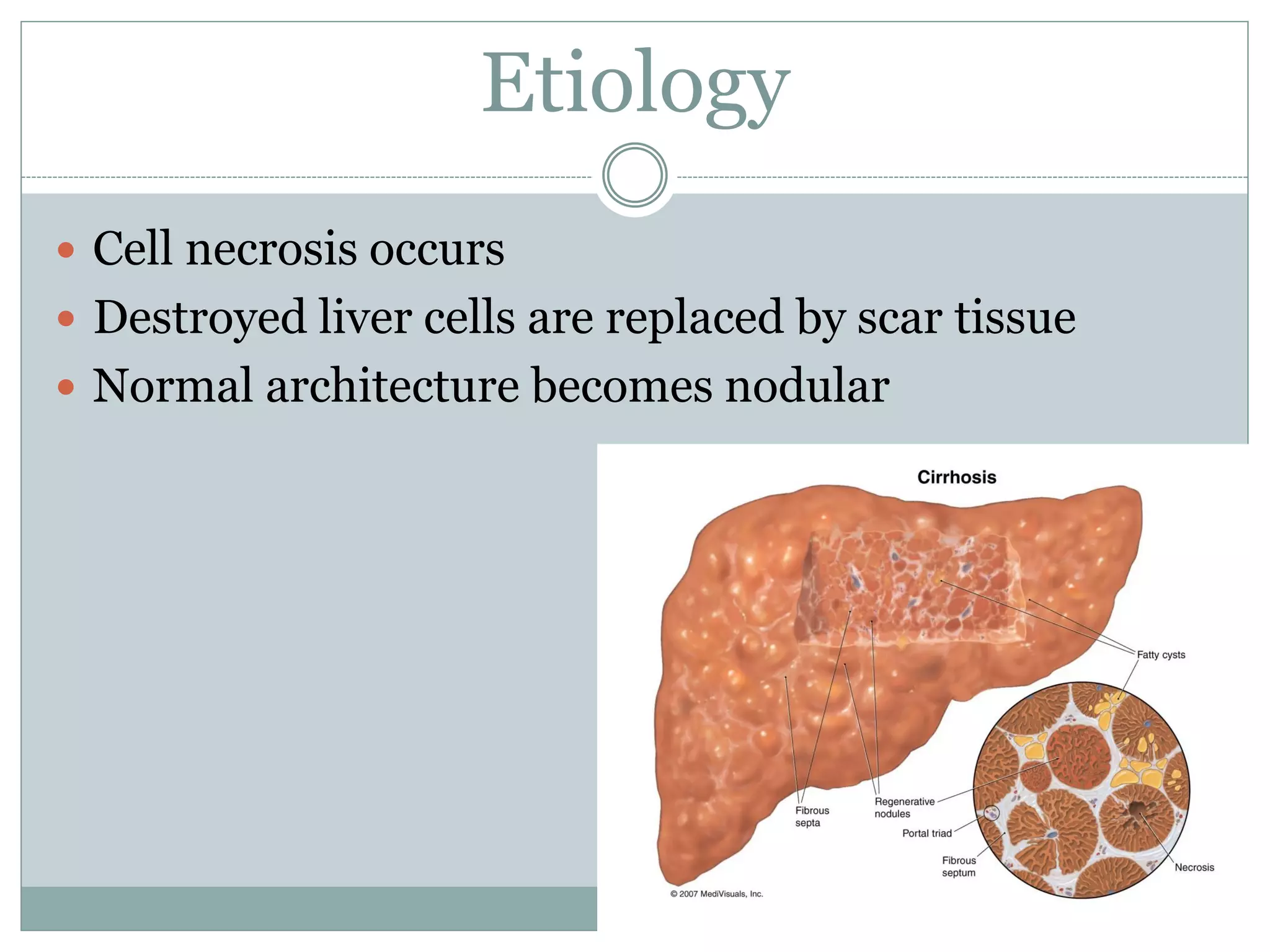 Liver cirrhosis | PDF