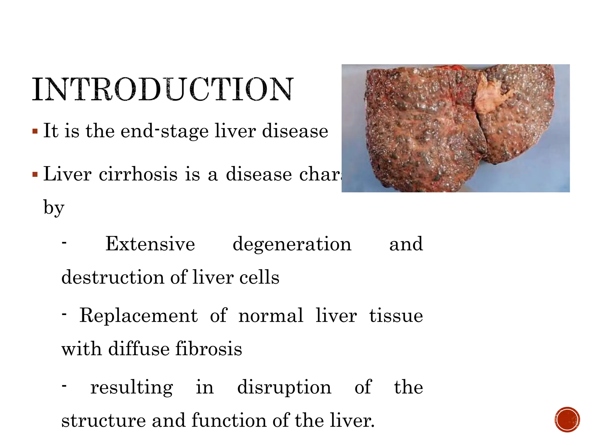 Liver Cirrhosis - etiology, types, pathophysiology, management ...