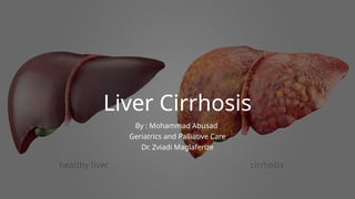 liver Cirrhosis liver liver liver f.pptx
