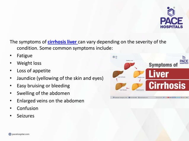 Liver Cirrhosis – Symptoms, Causes, Complications and Prevention | PPTX
