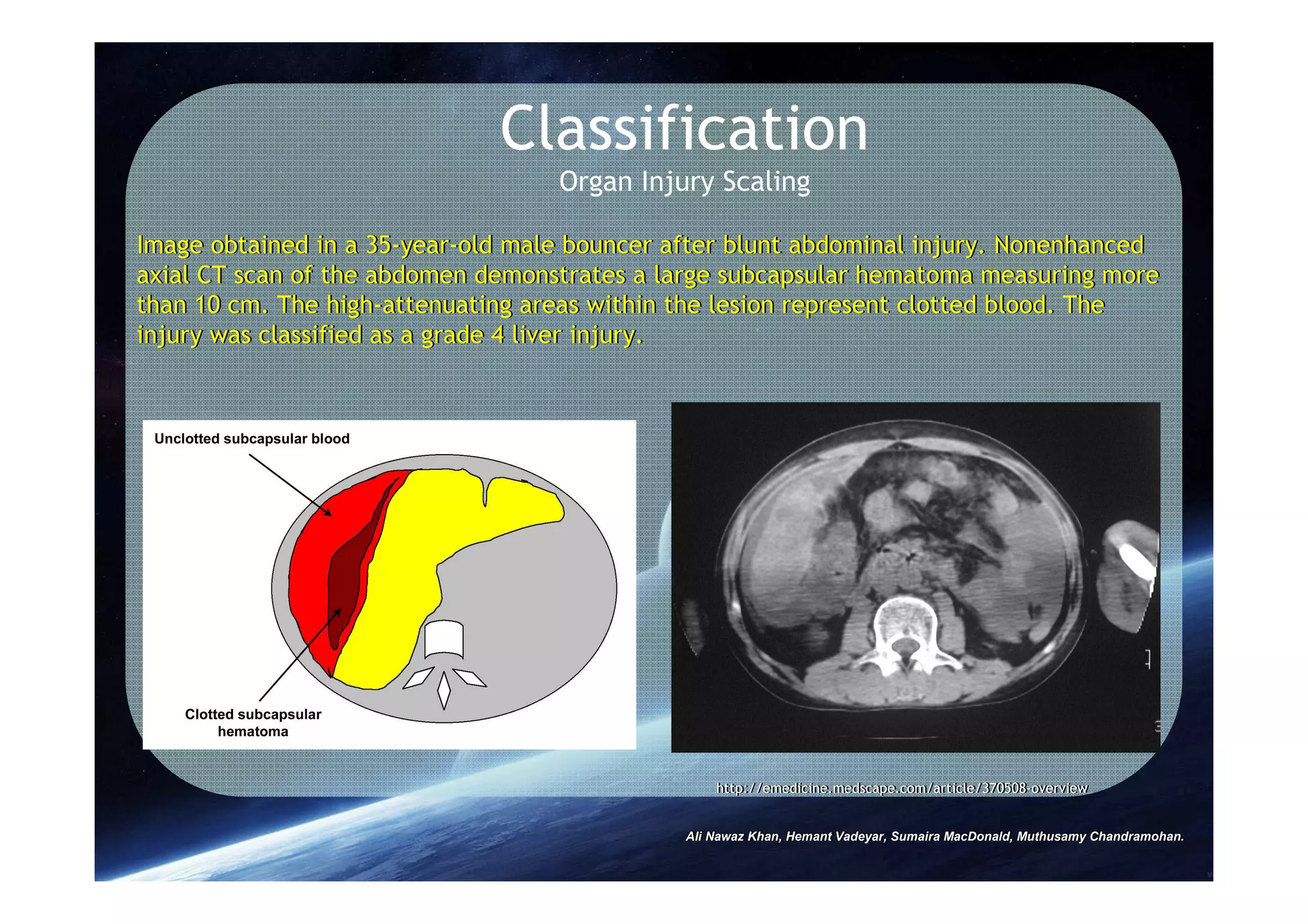 Liver Trauma: Classification | PDF