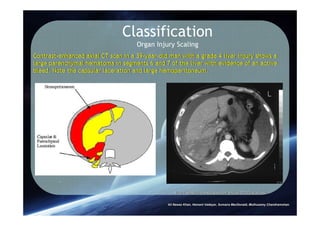 Liver Trauma: Classification | PDF