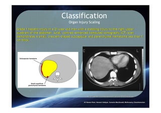 Liver Trauma: Classification | PDF
