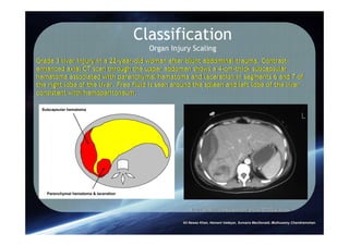 Liver Trauma: Classification | PDF