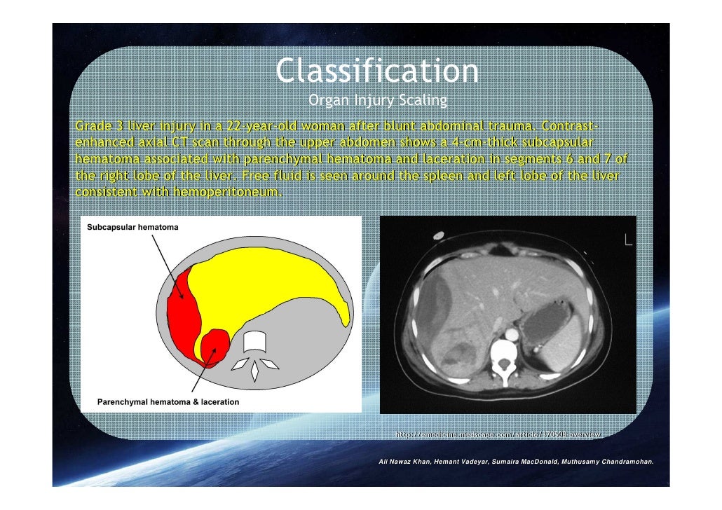 Liver Trauma: Classification