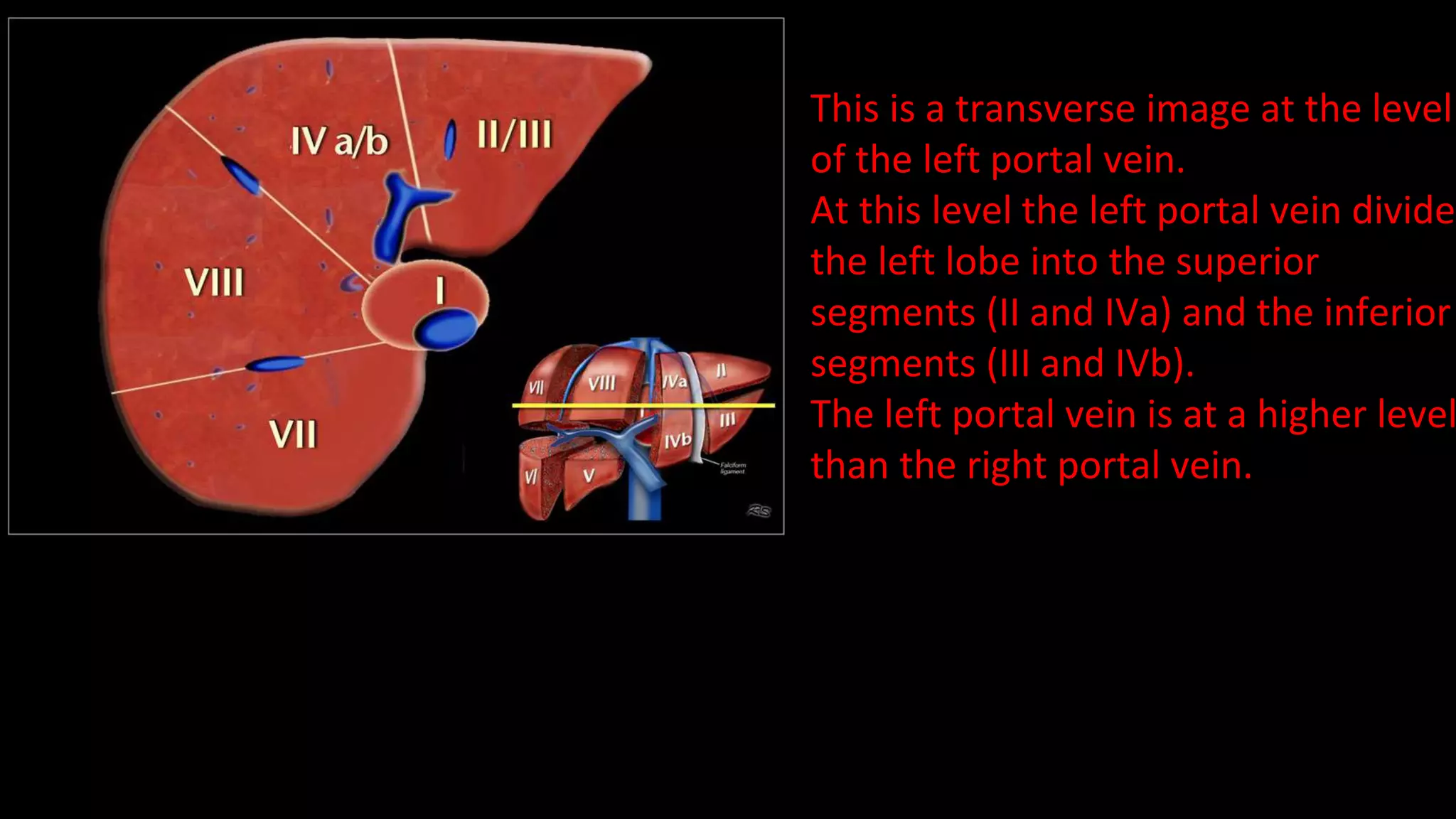 Liver ct anatomy 2.pptx