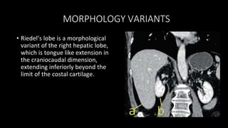 Liver ct anatomy 2.pptx