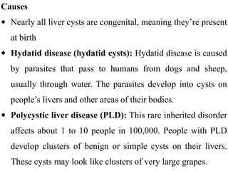 Liver Cyst.pdf