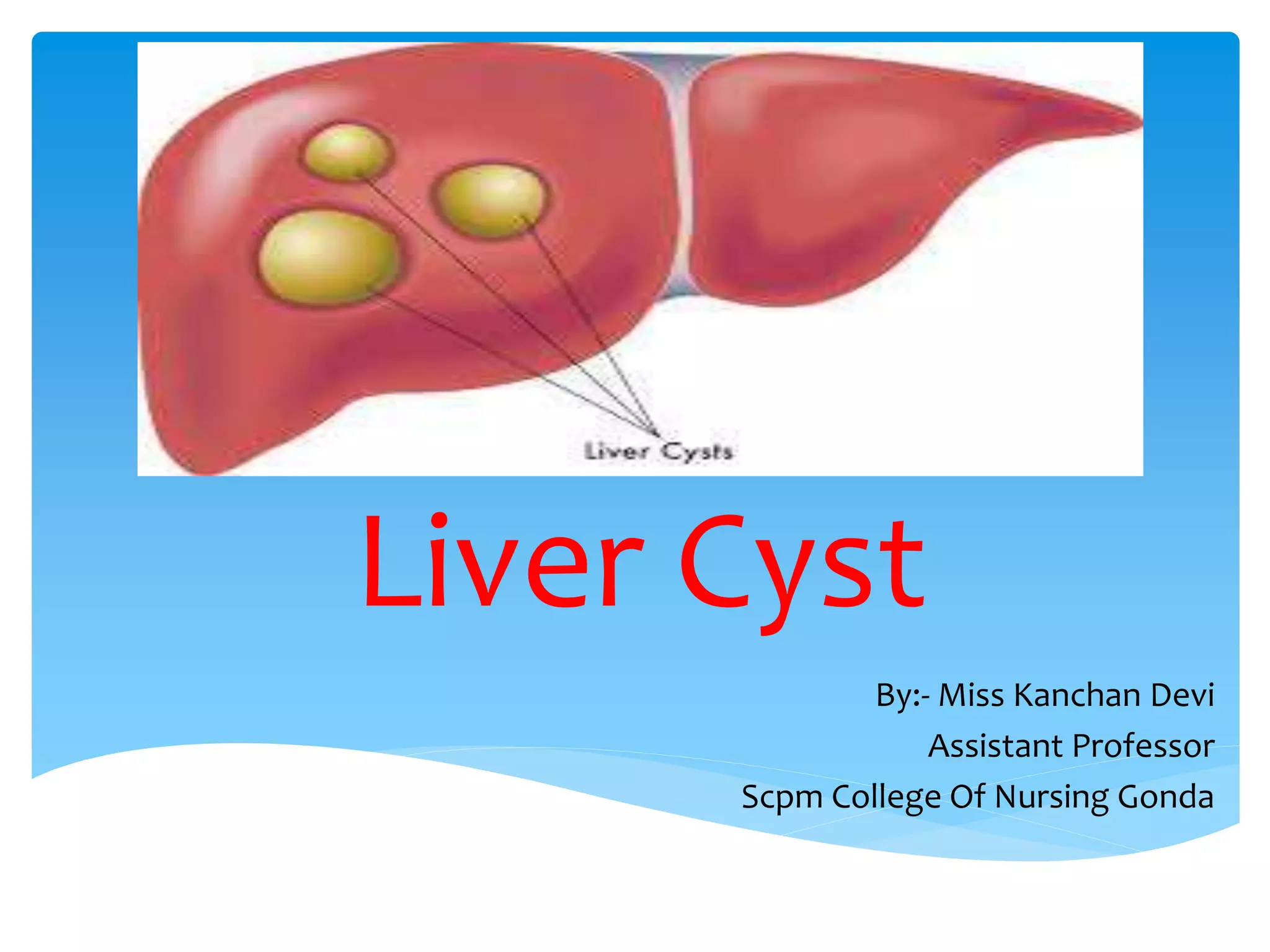 Liver Cyst.pptx