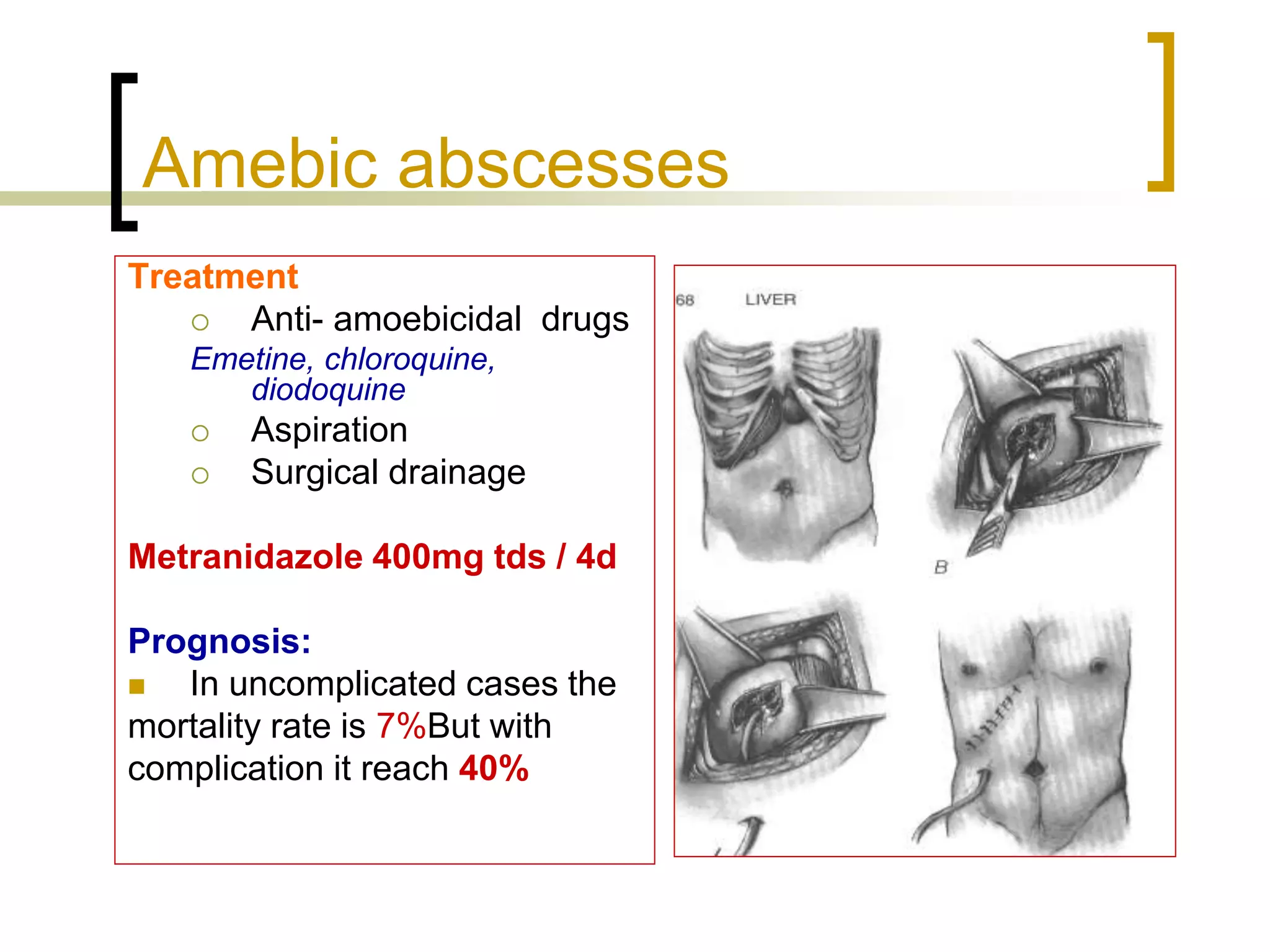 Liver cysts , Abscesses and Tumors | PPT