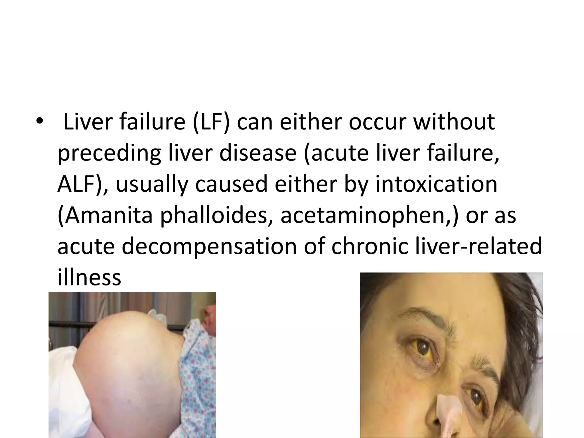 Liver dialysis | PPTX