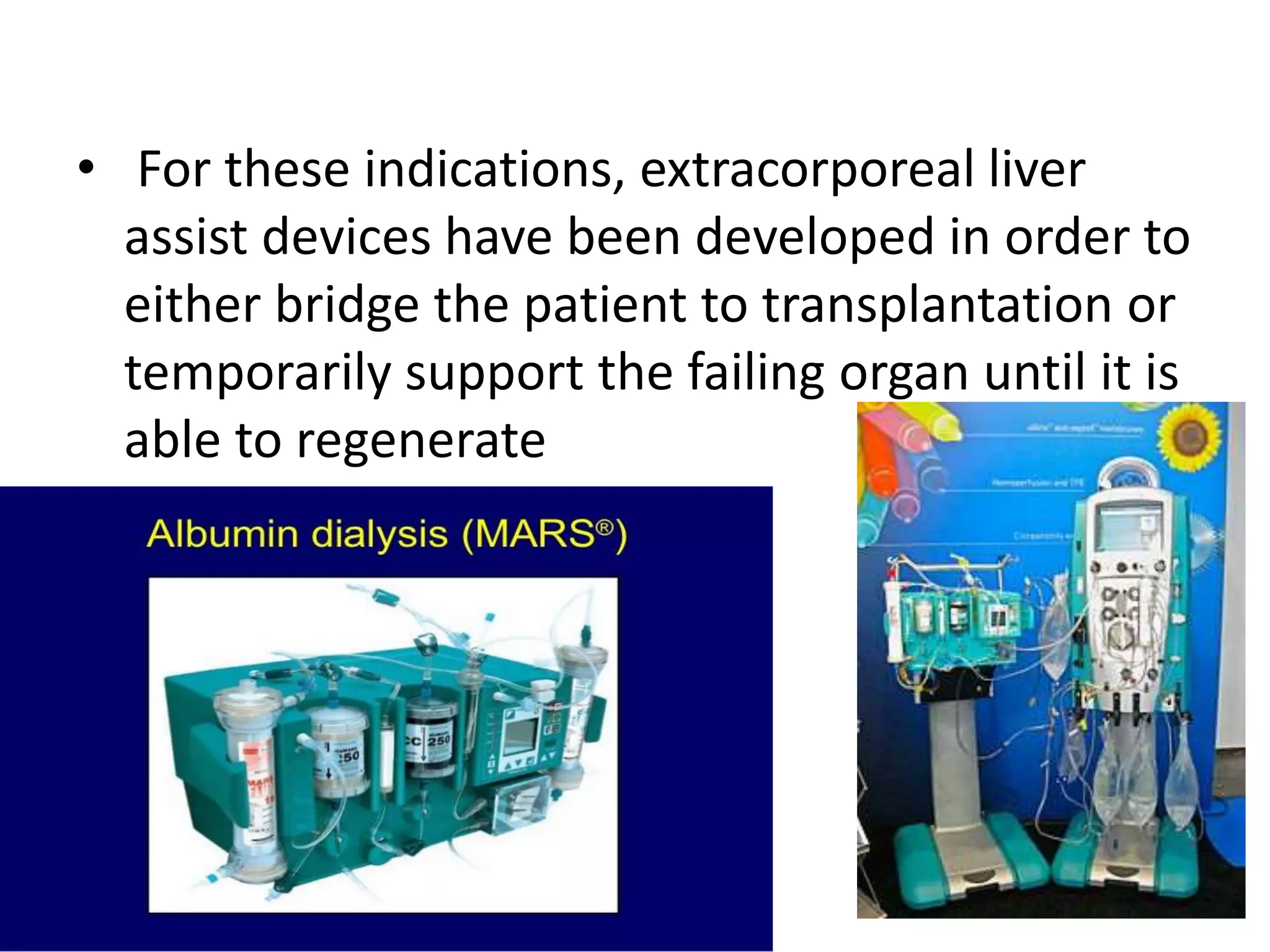 Liver dialysis | PPTX