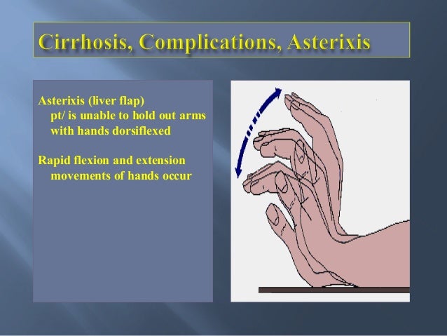 What Causes Flapping Tremor
