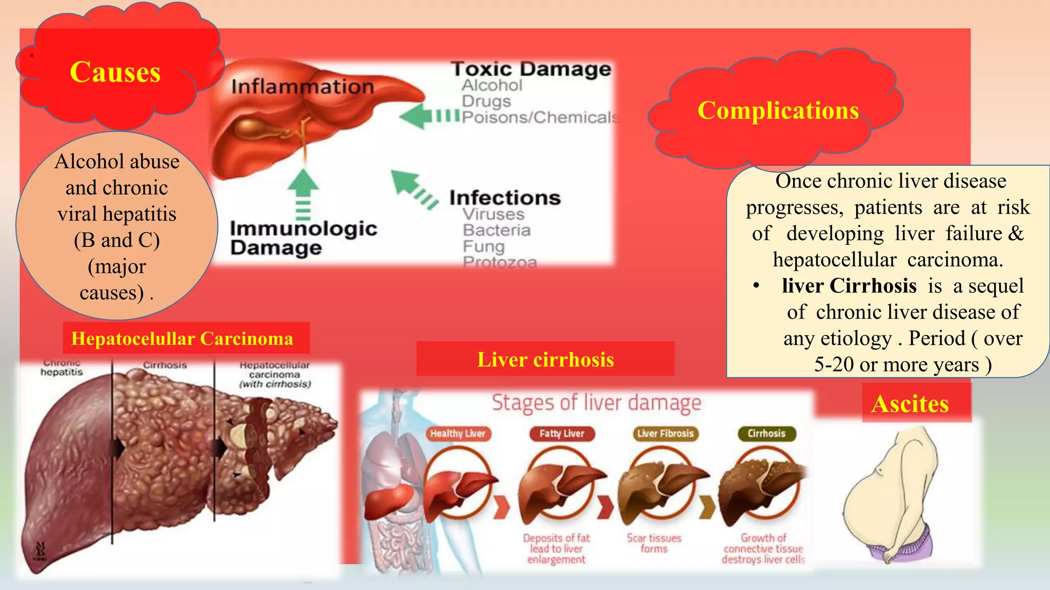 Liver disease (Case study,definition,indication,treatment,recovery ) | PPT