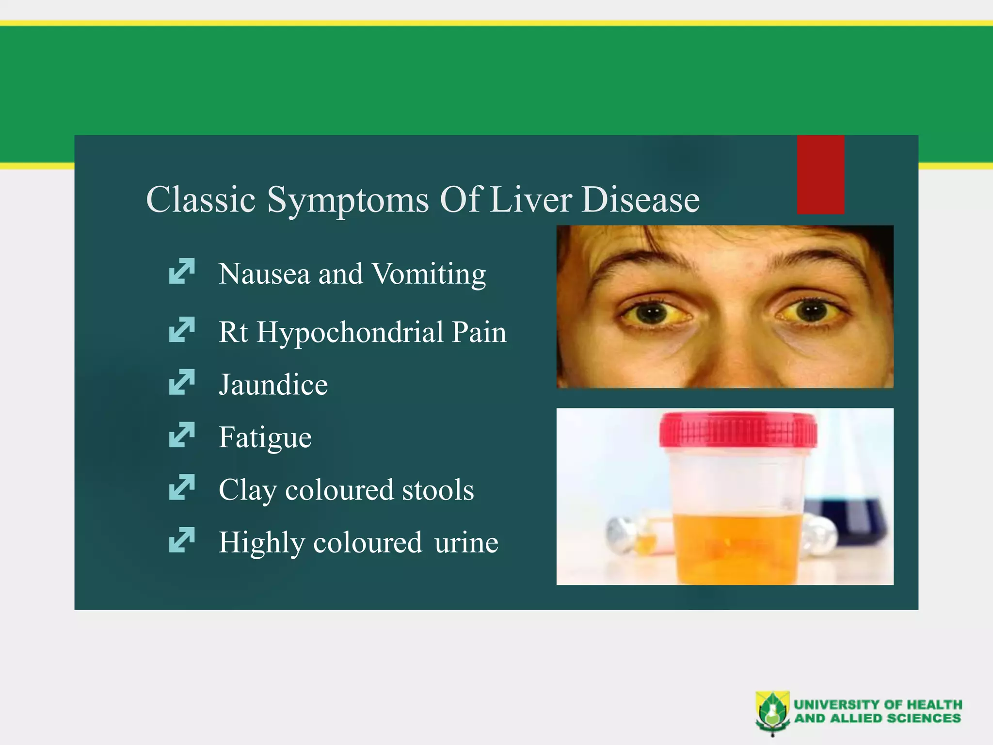 LIVER DISEASE PPT.pptx