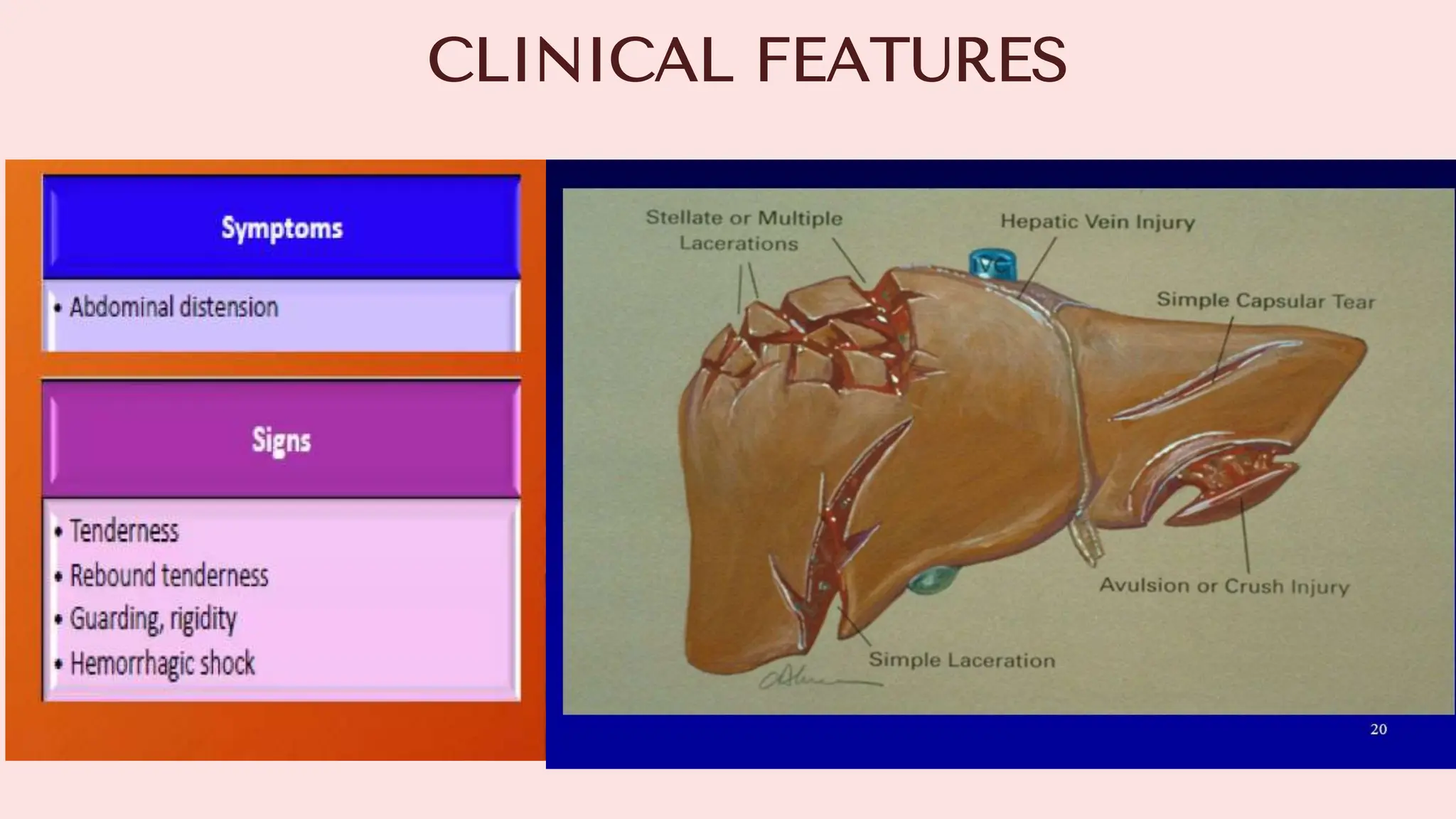 Liver Diseases_ Primary Biliary Cholangitis by Slidesgo.pptx