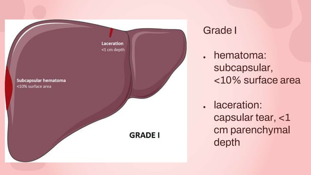 Liver Diseases_ Primary Biliary Cholangitis by Slidesgo.pptx