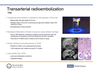Liver diseases symposium interventional techniques and downstaging of ...