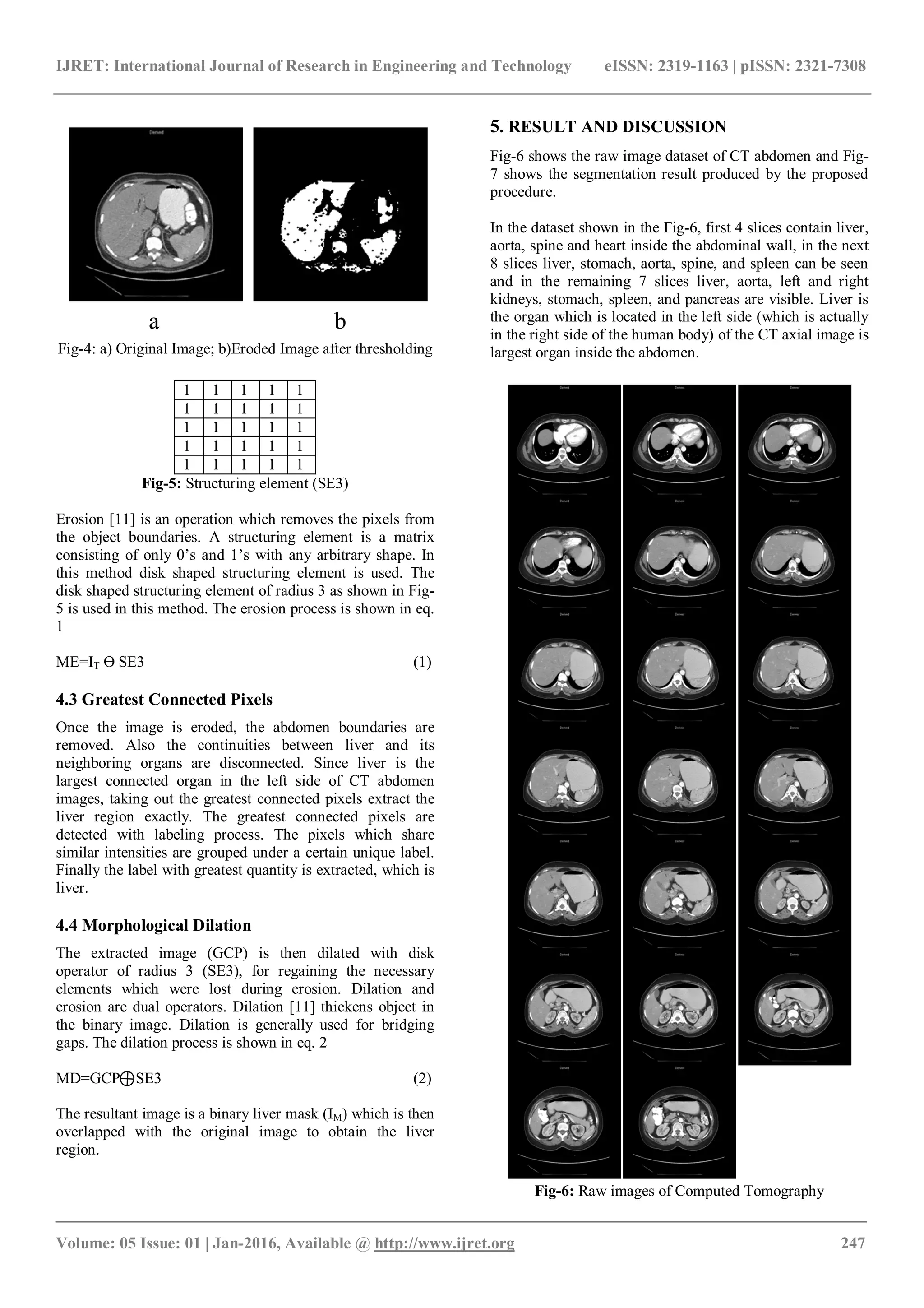 Liver extraction using histogram and morphology | PDF | Medical Tests ...