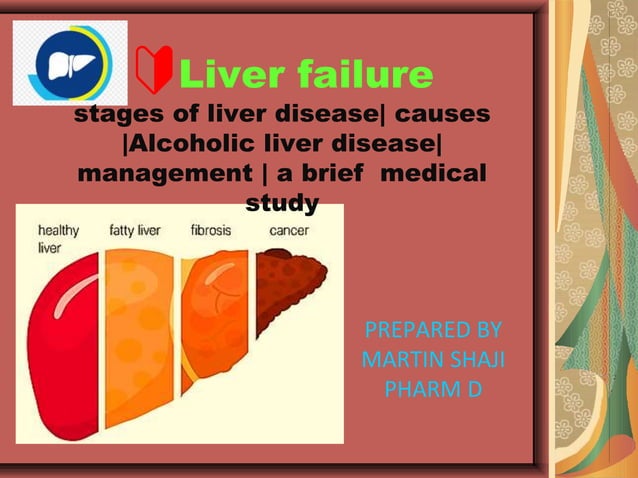 Liver failure -stages of liver disease| causes |Alcoholic liver disease ...