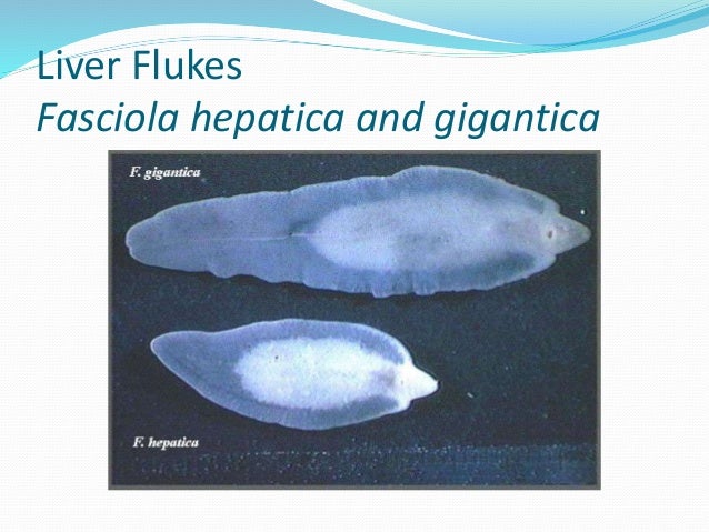 Liver flukes